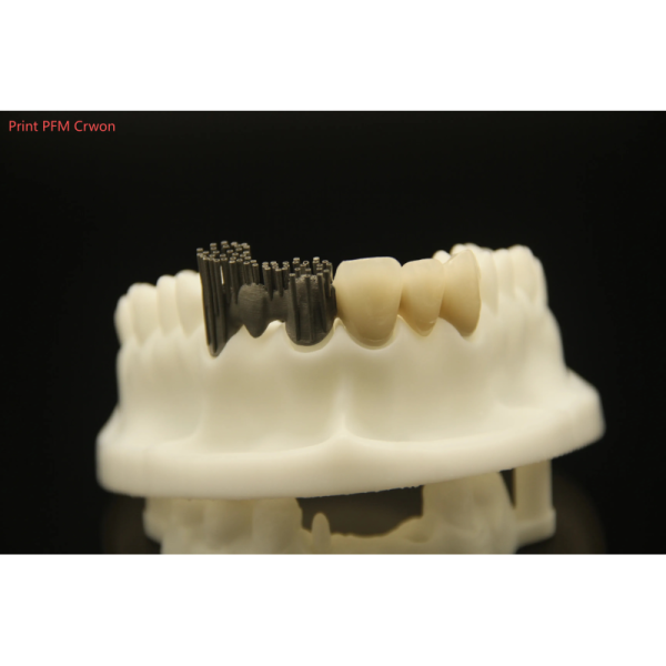 Quality Porcelain Dental Crown Tooth-Shaped Cap for Restoring Shape and Enhancing for sale