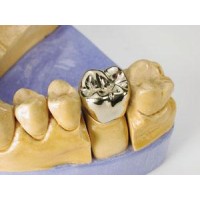 Quality Cobalt Chromium Alloy Dental Crown with CAD/CAM Milling for High Tensile for sale