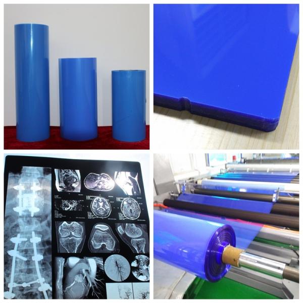 Quality ISO9001 Blue Inkjet Film Medical Inkjet Printing Film 11*14In for sale