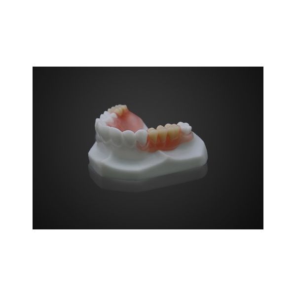 Quality Lightweight Comfortable Valplast Partial Denture Easy Cleaning High Transparency for sale