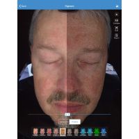 Quality Facial 3d Skin Analyzer Scanner Visia 32gb Storage For Doctor Skin Clinic for sale