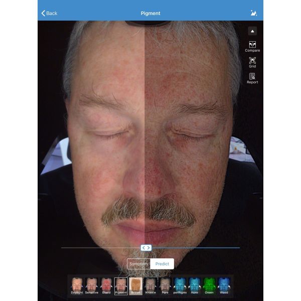 Quality Facial 3d Skin Analyzer Scanner Visia 32gb Storage For Doctor Skin Clinic for sale