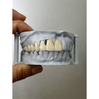 Quality Full Zirconia Crown with High Strength and Aesthetic Finish for Dental for sale