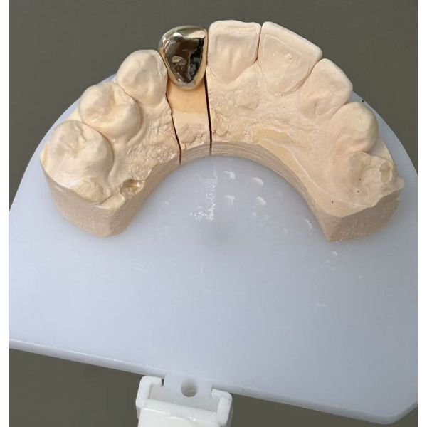 Quality Gold Open Window Crown for sale