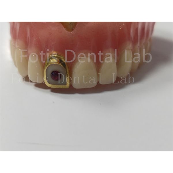 Quality Comfortable Full Acrylic Denture For Professionals Stain / Odor Resistant for sale
