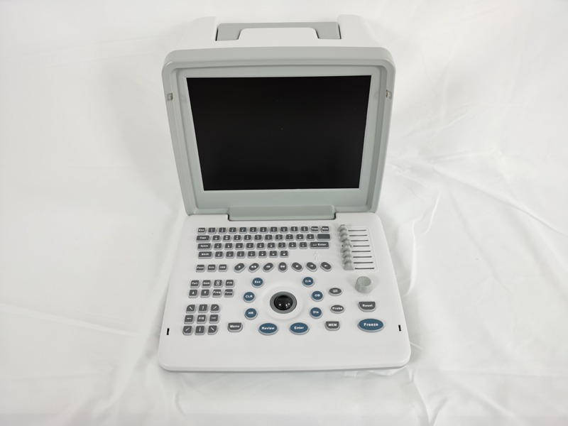 See Portable Pregnancy Laptop B W Scanner Wireless Fetal Doppler Probe Ultrasound Machine For Baby