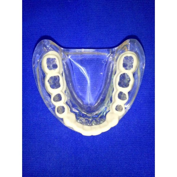 Quality Snap on Smile for sale
