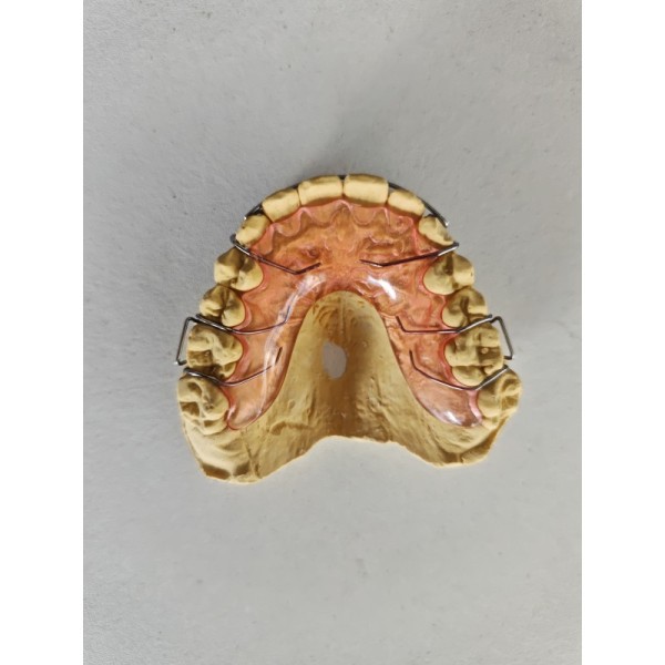 Quality Custom Molded Hawley Retainer with Adjustable Wire for Long-lasting Teeth for sale