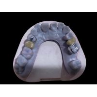 Quality Highly Precise PFM Crown Dental Alloy Ni Free Metal Porcelain Crowns for sale