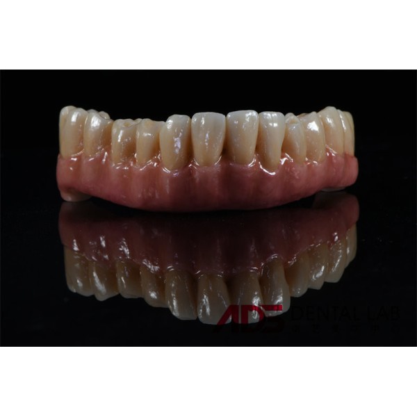 Quality Titanium Zirconia Implant Supported Dental Bridge All On 4 6 for sale