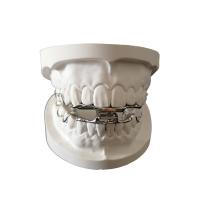 Quality OEM Dental Orthodontic Appliances High Strength 3D Digital Design for sale