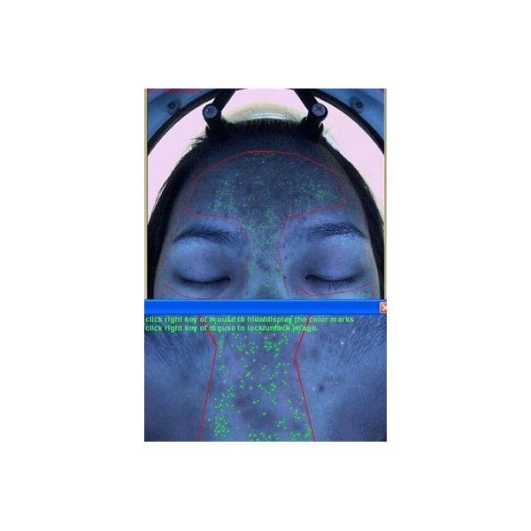 Quality RGB Moisture Skin Analyzer Machine , Moisture Analysis with 3D Function for sale