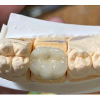 Quality Precise Esthetic Strong Dental PFM Porcelain Fused To Metal Crown In Dentistry for sale