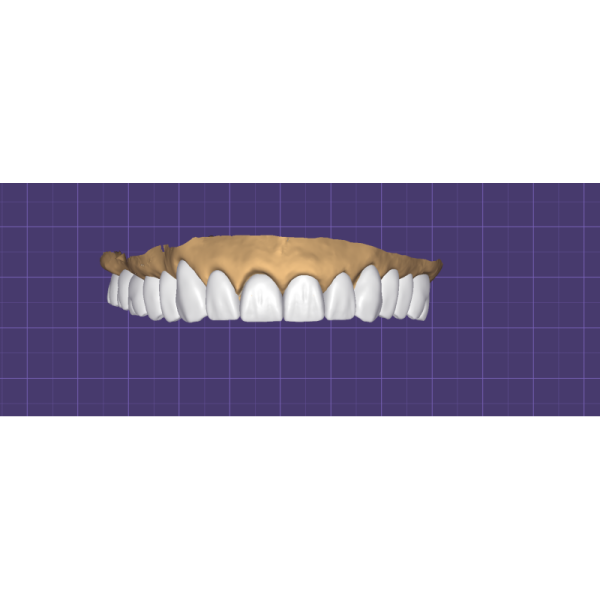 Quality Precision Fit Digital Wax Up Dental Study Model with Durable and Biocompatible for sale