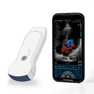 Quality POCUS Portable IPad Handheld Ultrasound Scanner For Clinical Diagnosis for sale