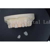 Quality Custom Artificial Dental Lab Veneers With Superior Stain Resistance for sale