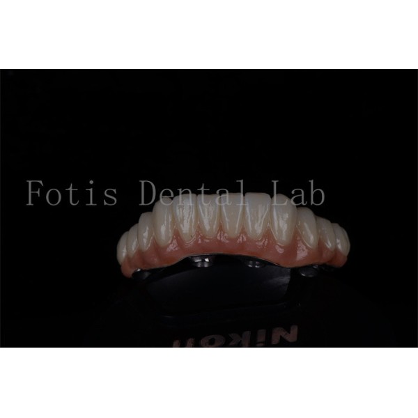 Quality Full Mouth Restoration All On 4 And All On 6 Titanium Or Zirconia Highly Success Rate for sale