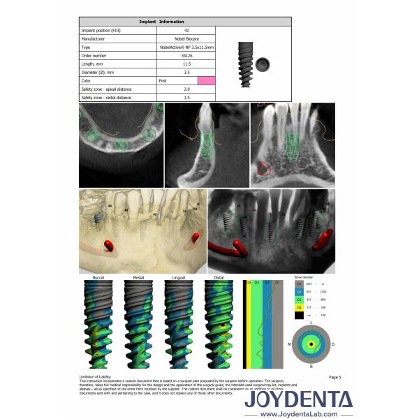 Quality Guided Surgery Solutions Single Use 2mm Thickness for Digital Implant Planning for sale