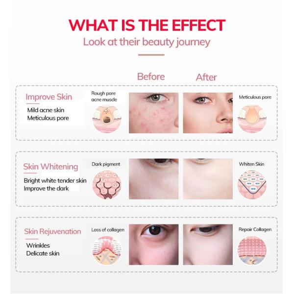 Quality 1000w Anti Aging Red Light Therapy Machines 660nm 850nm Device for sale