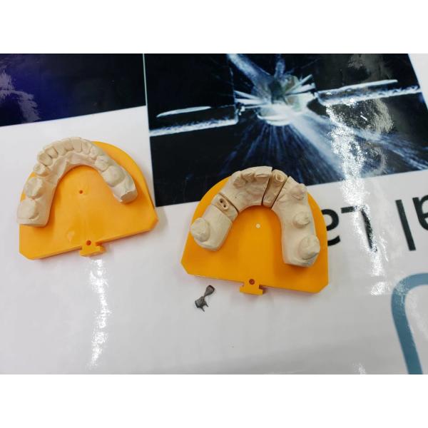 Quality Full Metal PFM Dental Crown Bridge High Tech Biological Material for sale