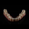 china Fixed Restorations Full Arch Zirconia Implant Bridge Denture Teeth