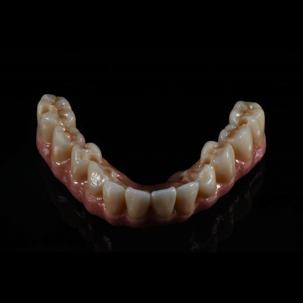 Quality Fixed Restorations Full Arch Zirconia Implant Bridge Denture Teeth for sale