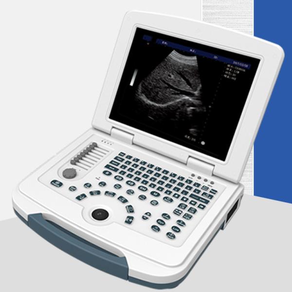 Quality China cheapest medical portable  full digital color doppler b ultrasound scanner/scan/machine price for pregnancy with p for sale