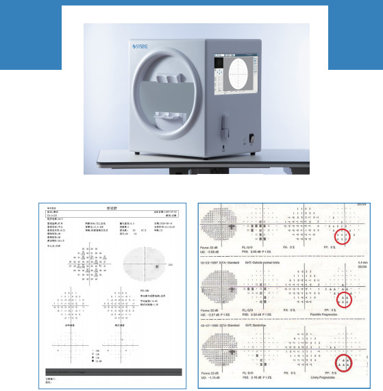 Quality Automated Perimetry Visual Field Test Machine 60Hz Small Size for sale