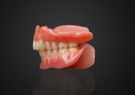 Temparary/immediate adsorptive denture