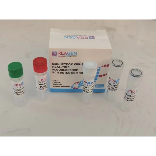 Quality High Sensitivity Monkeypox PCR Test Kit Fluorescence Real Time PCR Detection Kit for sale