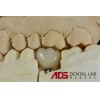 china Dental Teeth Full Mouth Zirconia Implants Abutment Custom CAD CAM