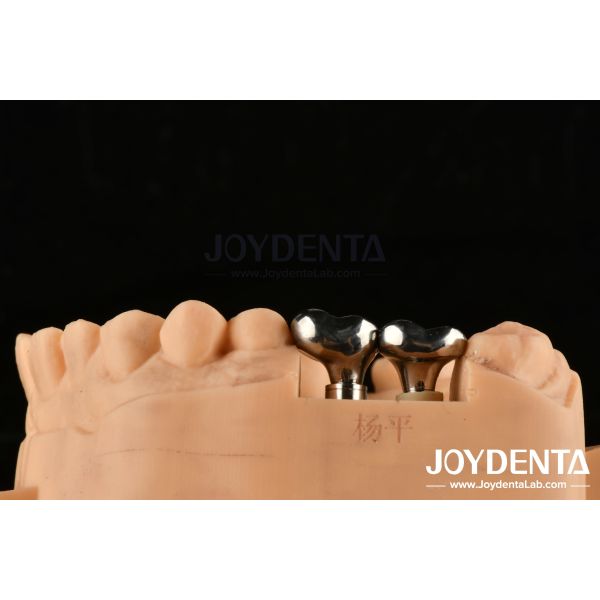Quality Silver Dental Implant Abutments Customizable Diameter Height CAD CAM Technology for sale
