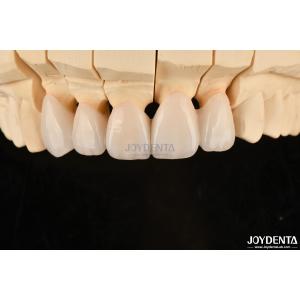 Quality Highly Customizable Layered Zirconia Dental Crowns And Bridges Long Lasting for sale