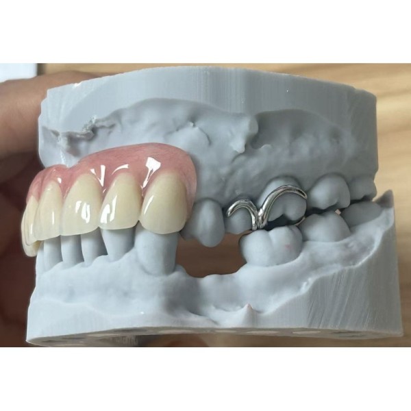 Quality Metal Framework with acrylic partial denture finish for sale