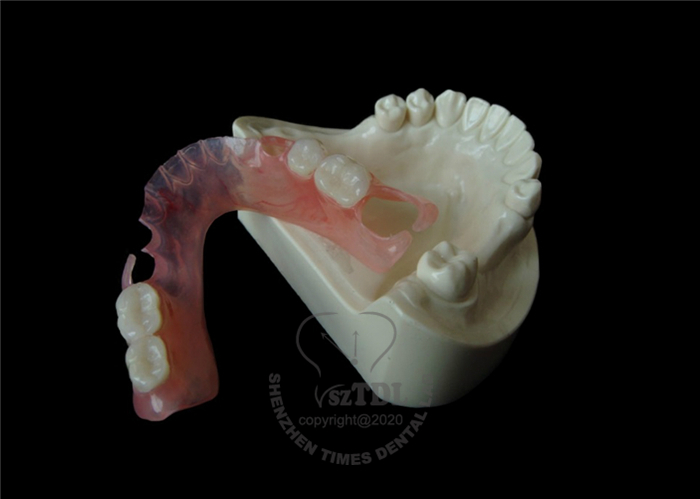 ISO Acrylic Removable Partial Denture , Tcs Flexible Partial Dentures ...
