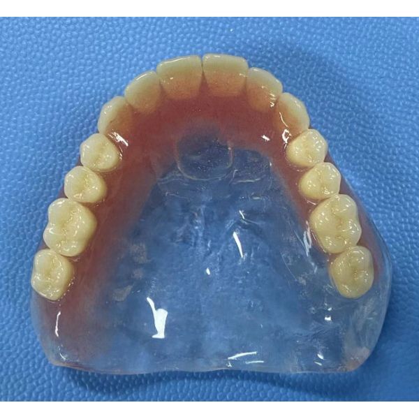 Quality Easy To Clean Full Acrylic Denture Highly Elastic for long term use for sale