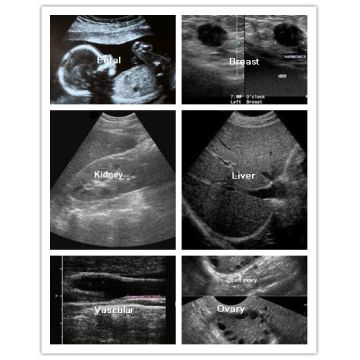 Quality Ultrasound Scan Equipment Portable Ultrasound Scanner Ipad Ultrasound Machine for sale