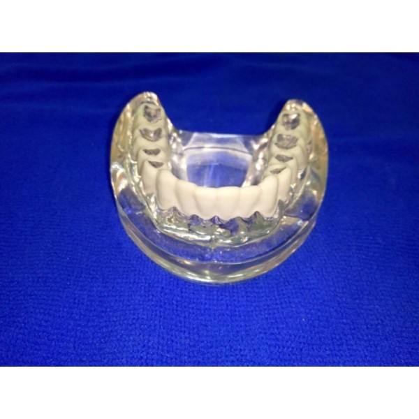 Quality Snap on Smile for sale