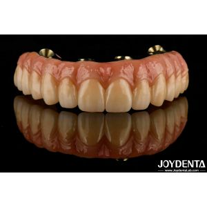 Quality Dental Ti-Bar Hybrid Zirconia Bridge Excellent Strength Restores Chewing for sale