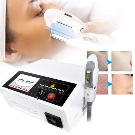 Quality Hair Removal IPL Skin Laser Machine For Skin Rejuvenation Acne Pigmentation Treatment for sale