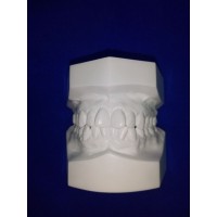 Quality Dental Study Model with CAD CAM Digital Design and 3D Printing Workflow for for sale