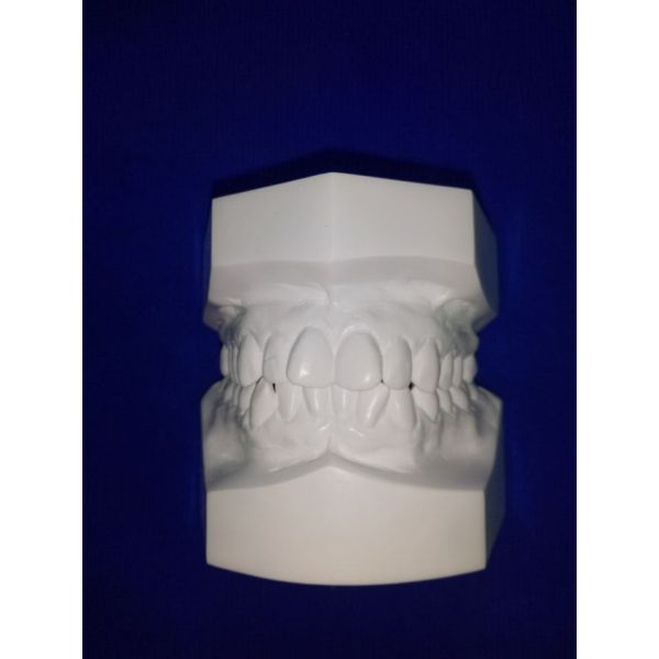 Quality Dental Study Model with CAD CAM Digital Design and 3D Printing Workflow for for sale
