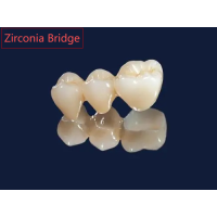 Quality High Strength Biocompatible Aesthetic Zirconia Dental Crown for Natural Look for sale