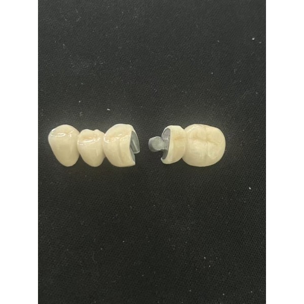 Quality Precision Fit Durable Key and Keyway for Secure Insertion in Mechanical for sale