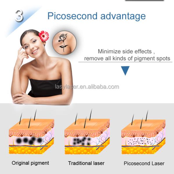 Quality Flawless 808nm Diode Laser Painless Hair Removal Machine for sale