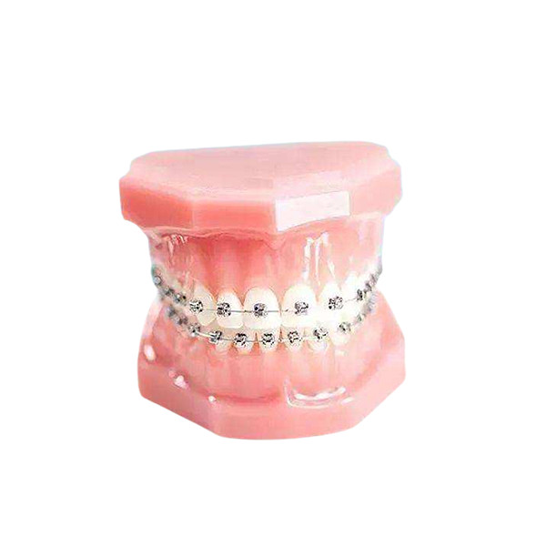 Quality Smooth Surface Orthodontic Metal Bracket Durable Fixed Appliance for sale