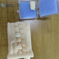 Quality Aesthetic Zirconia Dental Restorations Zirconia Porcelain Crowns for sale