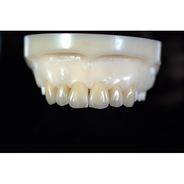 Quality Zirconia All-Ceramic Teeth Crowns & Bridges for sale