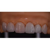 Quality Digital Crowns for sale