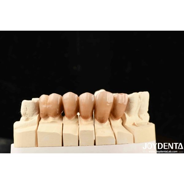 Quality Bionic Teeth Layered Zirconia with Bionic Leaf Micro-Engraving and Multi-color for sale